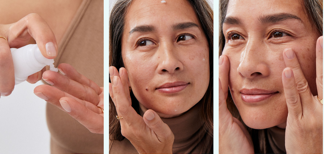 Ro joins teledermatology bandwagon with Ro Derm and a $150 million ...